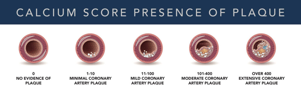 Difference Between Coronary Calcium Scoring and Coronary CT Angiogram
