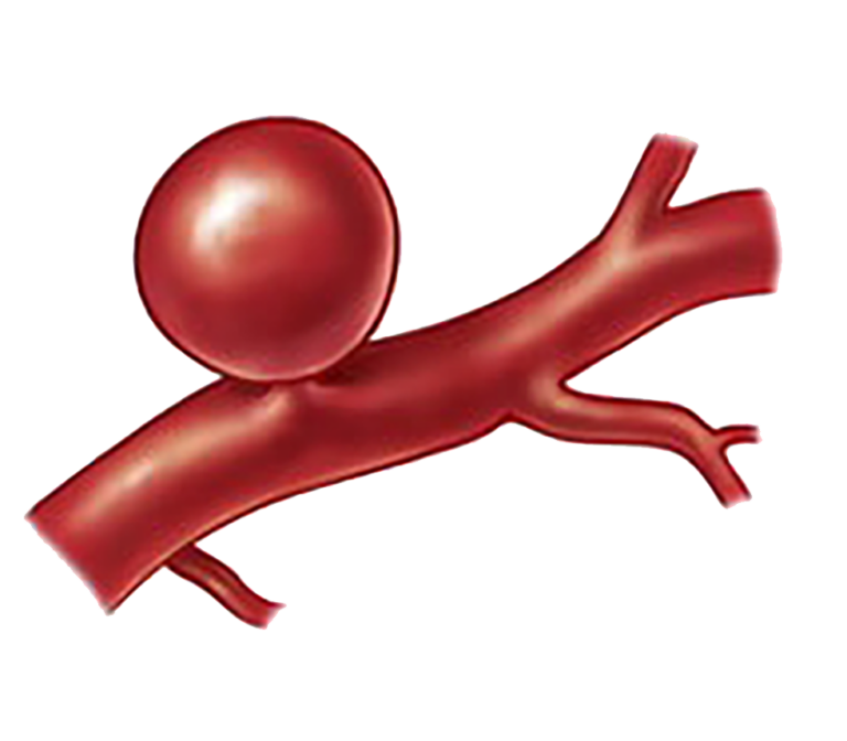 Brain Aneurysms: A Family Connection | Consulting Radiologists